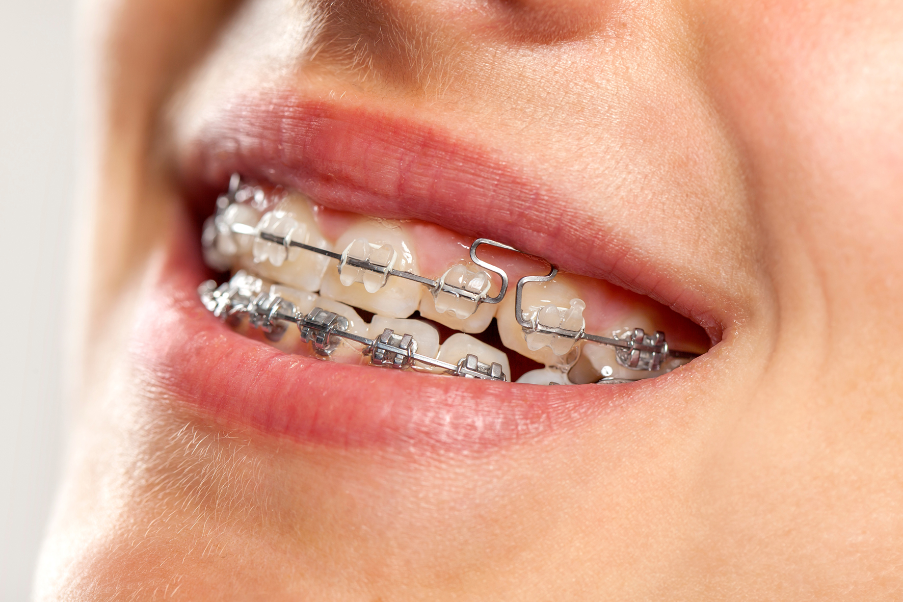 Der richtige Bogen | Dr. Scharenberg und Schmidt | Fachpraxis für ...